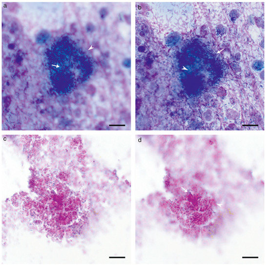 The Role of Biofilms in the Pathogenesis of Animal Bacterial Infections