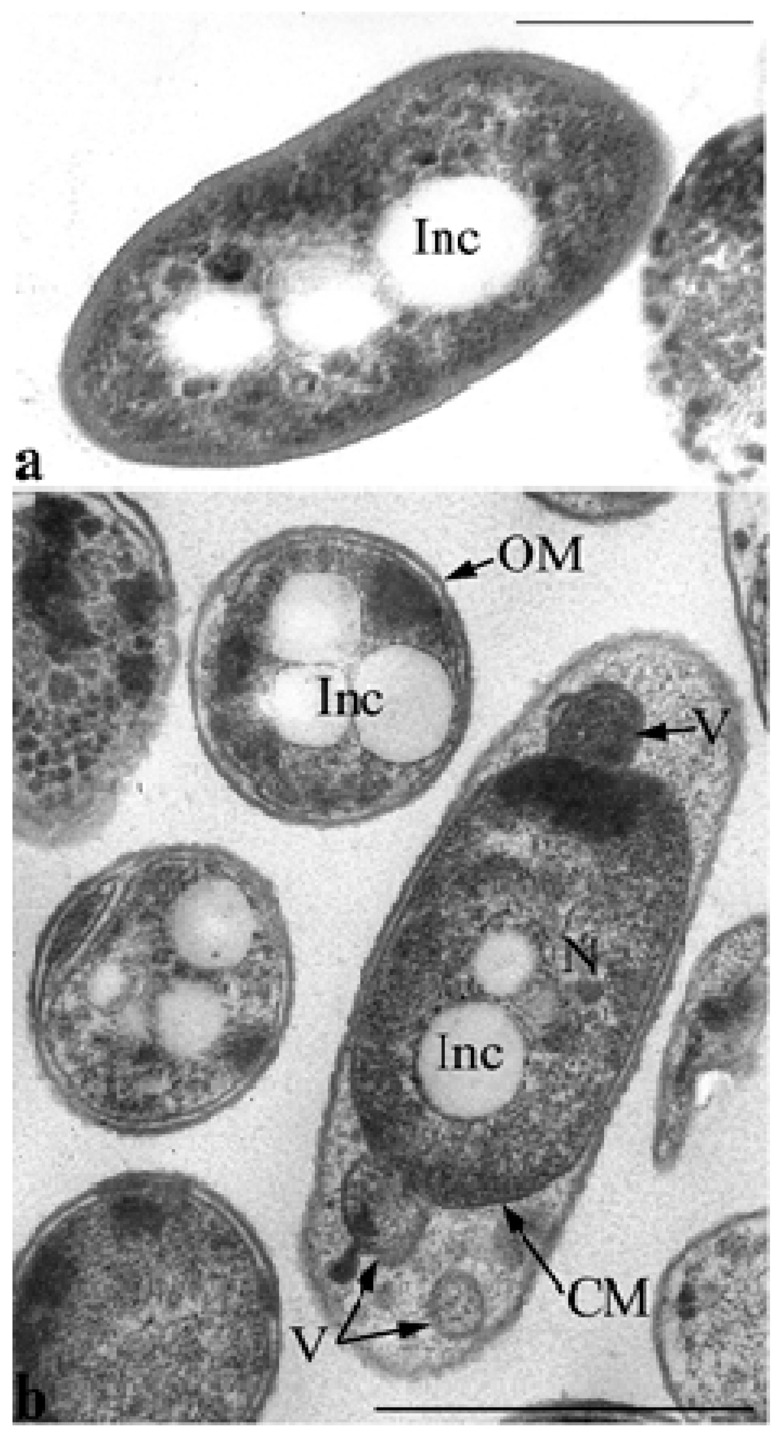 Characterization of a New Pseudomonas Putida Strain Ch2, a Degrader of ...