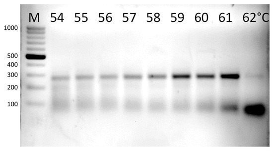 Improved Quantitative Real-Time PCR Protocol for Detection and ...