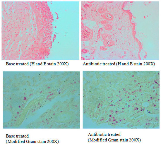 A Simple In-Vivo Method for Evaluation of Antibiofilm and Wound Healing ...