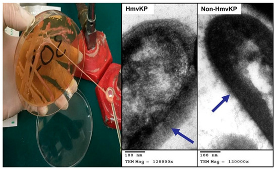 Microorganisms | Free Full-Text | Occurrence and Molecular Study of ...