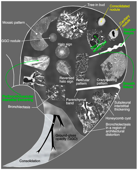 Clinicopathological and Radiological Features of Cats Presented with ...