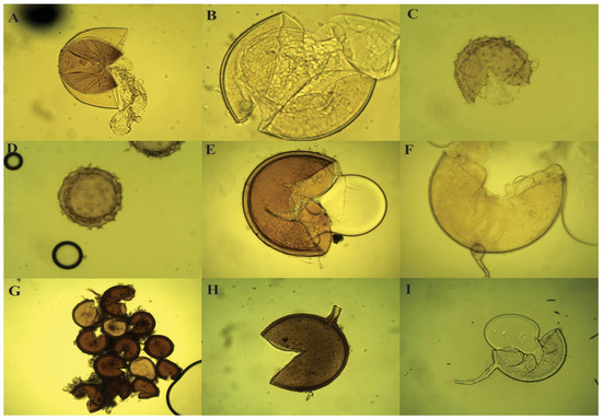 Impact of Water Shortage on Soil and Plant Attributes in the Presence ...