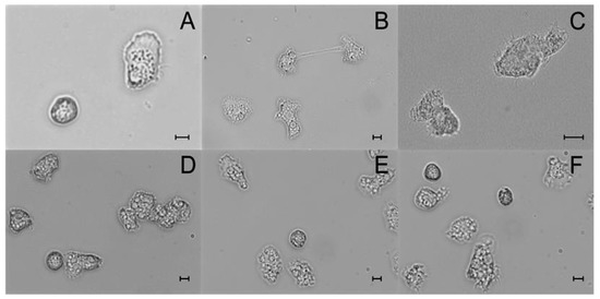 Successive Acanthamoeba Corneal Isolates Identified in Poland Monitored ...