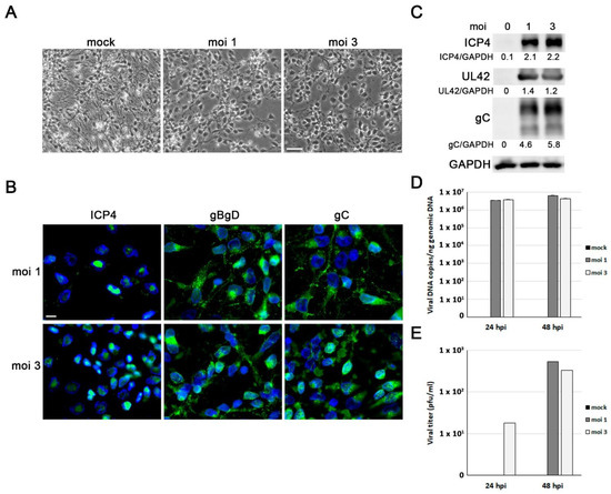 Herpes Simplex Virus Type 1 Induces AD-like Neurodegeneration Markers ...