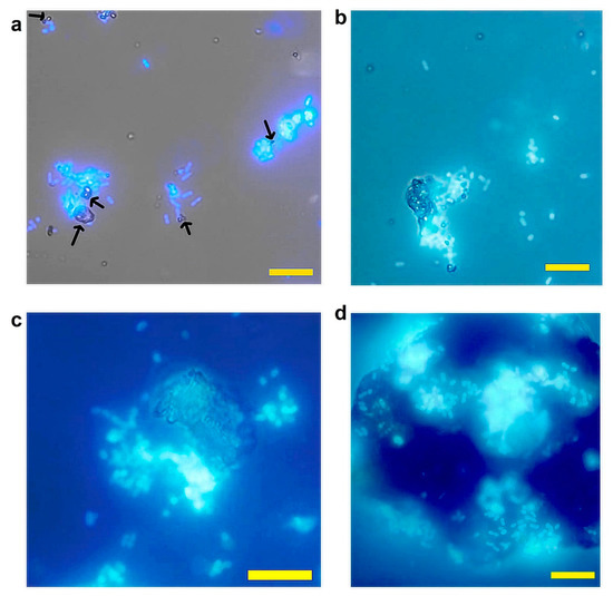 Klebsiella aerogenes Adhesion Behaviour during Biofilm Formation on ...