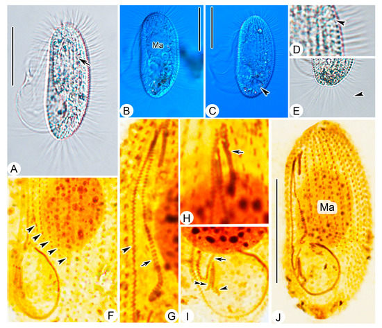 Taxonomic and Phylogenetic Studies of Two Brackish Pleuronema Species ...