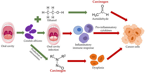 A Putative Role of Candida albicans in Promoting Cancer Development: A ...