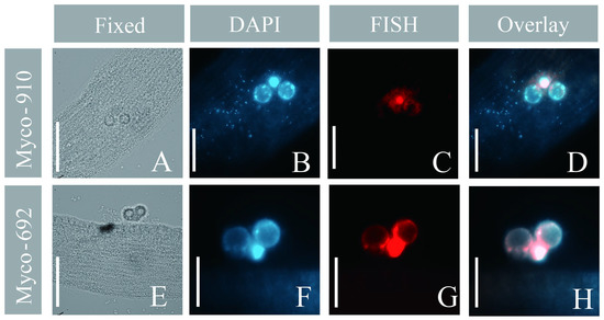 Culture-Independent Single-Cell PacBio Sequencing Reveals Epibiotic ...