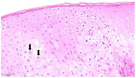 Monkeypox: A Histopathological and Transmission Electron Microscopy Study