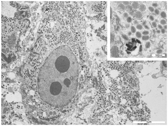 Monkeypox: A Histopathological and Transmission Electron Microscopy Study