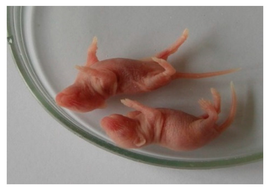 Study of Viral Coinfection of the Ixodes persulcatus Ticks Feeding on ...