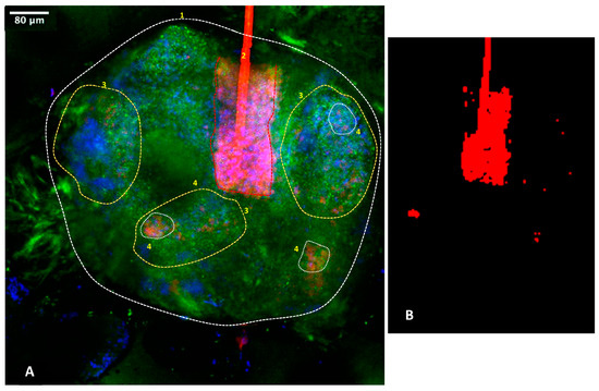 The World’s First Acne Dysbiosis-like Model of Human 3D Ex Vivo ...