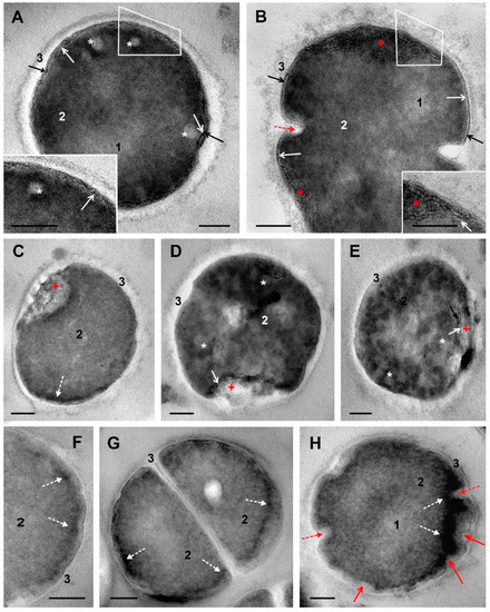Changes in the Ultrastructure of Staphylococcus aureus Cells Make It ...