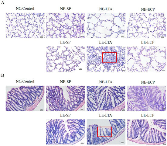 Mechanisms of Lung and Intestinal Microbiota and Innate Immune Changes ...