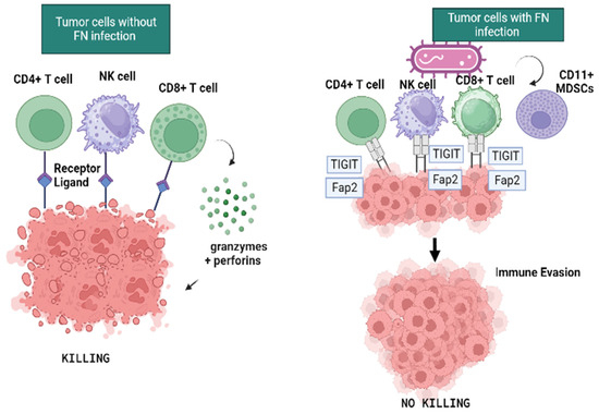 Fusobacterium and Colorectal cancer