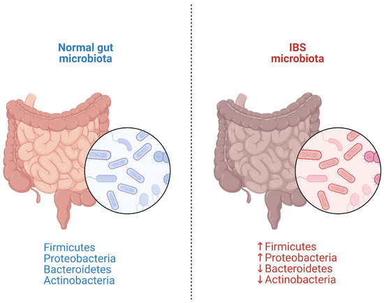 Gut Dysbiosis in Irritable Bowel Syndrome: A Narrative Review on ...