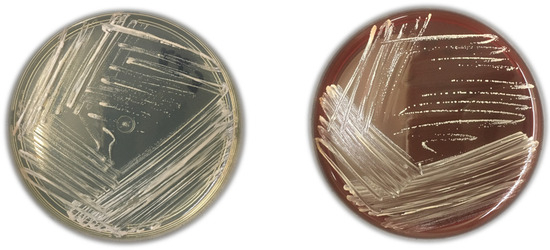 Phenotypic and Genotypic Characterization of Cutibacterium acnes ...