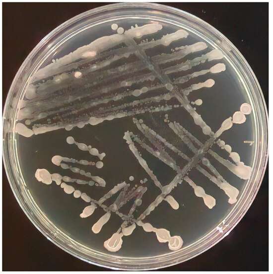 Biological Characterization and Whole-Genome Analysis of Bacillus ...