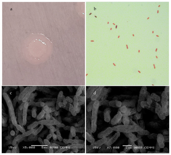 Unveiling the Probiotic Potential of the Anaerobic Bacterium ...