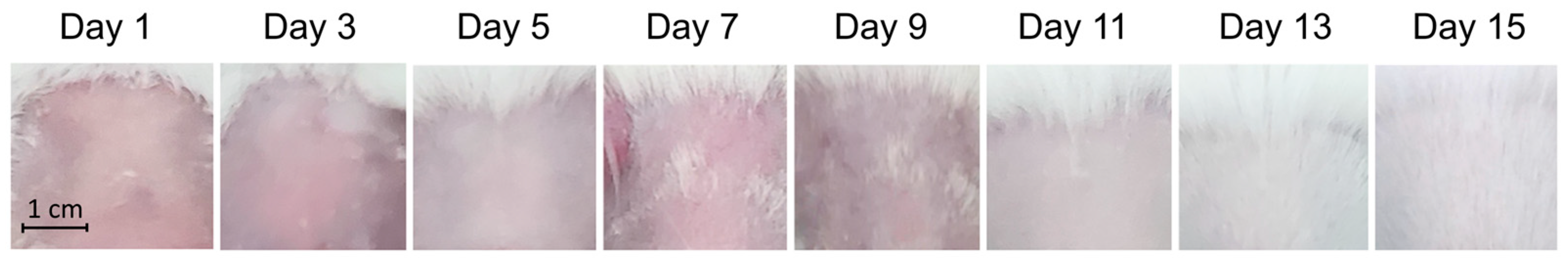 A Combination of Blue Light at 460 nm and H2O2 for the Safe and ...