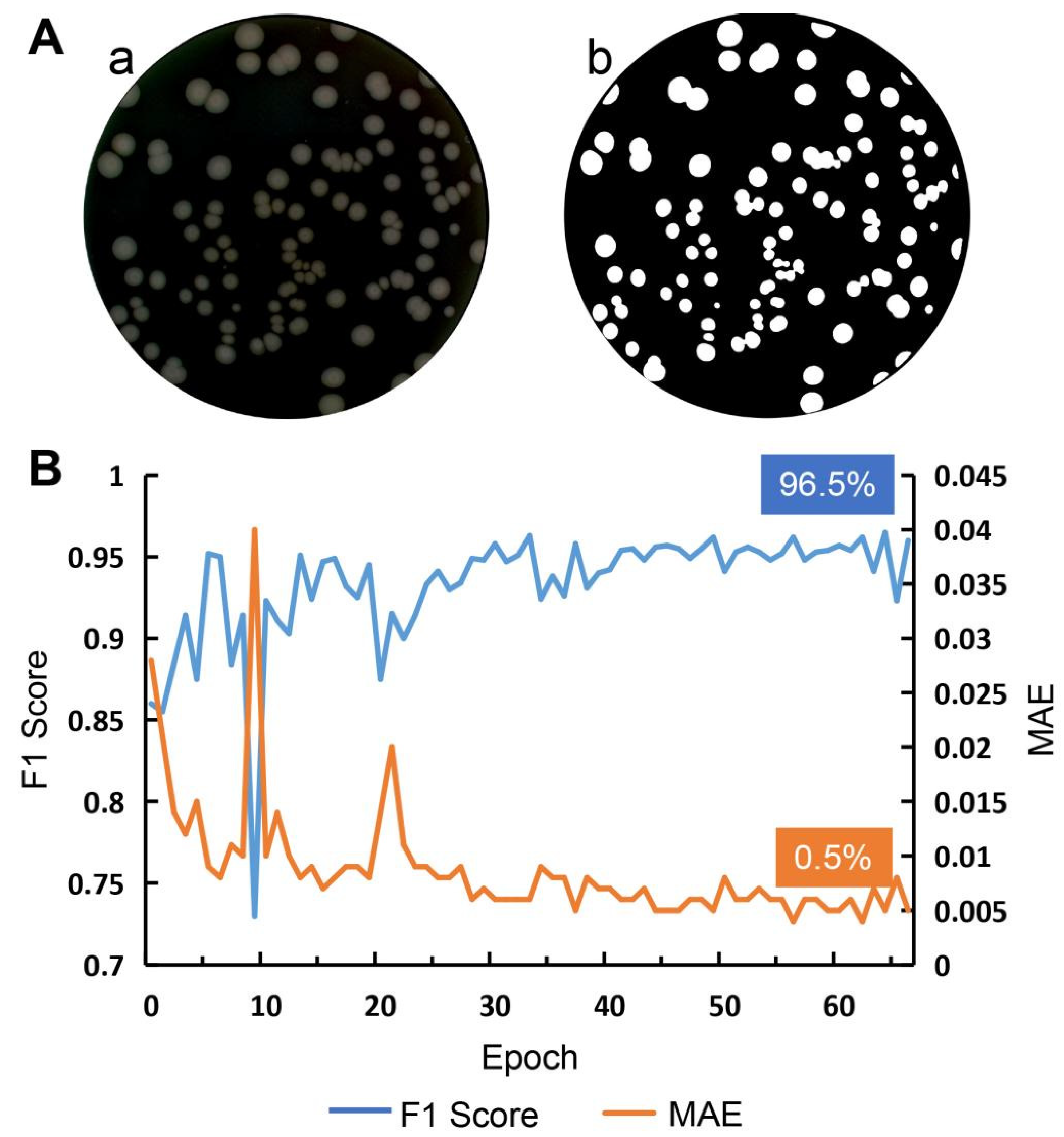 U2-Net and ResNet50-Based Automatic Pipeline for Bacterial Colony Counting