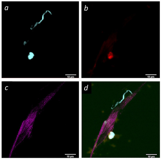 Bartonella- and Borrelia-Related Disease Presenting as a Neurological ...