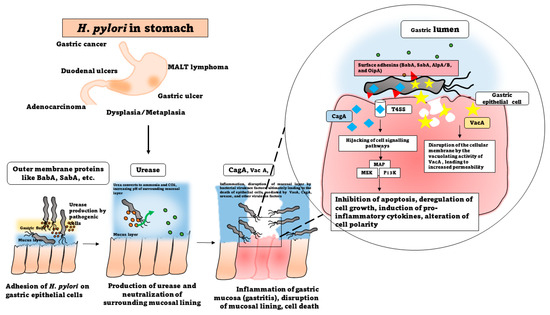 Helicobacter pylori: A Contemporary Perspective on Pathogenesis ...