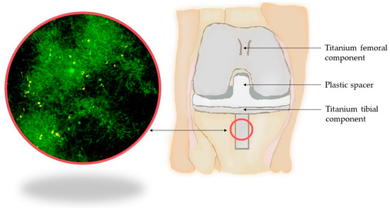 Modern Microbiological Methods to Detect Biofilm Formation in Orthopedy ...