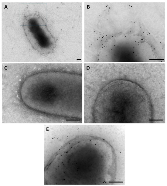 Presence and Role of the Type 3 Fimbria in the Adherence Capacity of ...