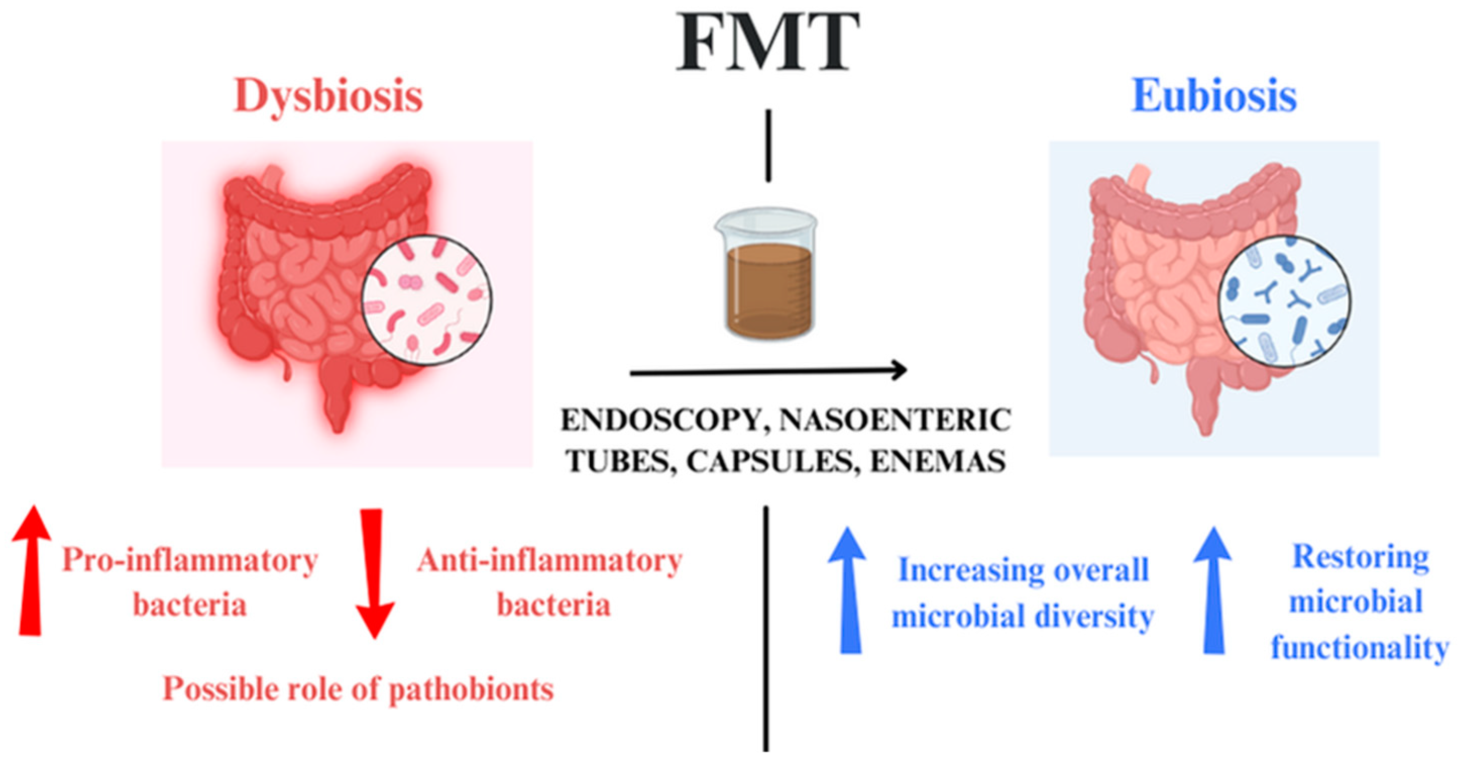 Microorganisms | Free Full-Text | The Role of Fecal Microbiota Transplantation in IBD