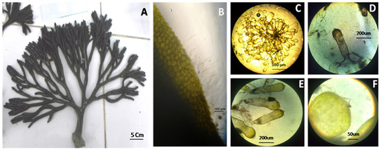 Epibiotic Bacteria Isolated from the Non-Indigenous Species Codium ...