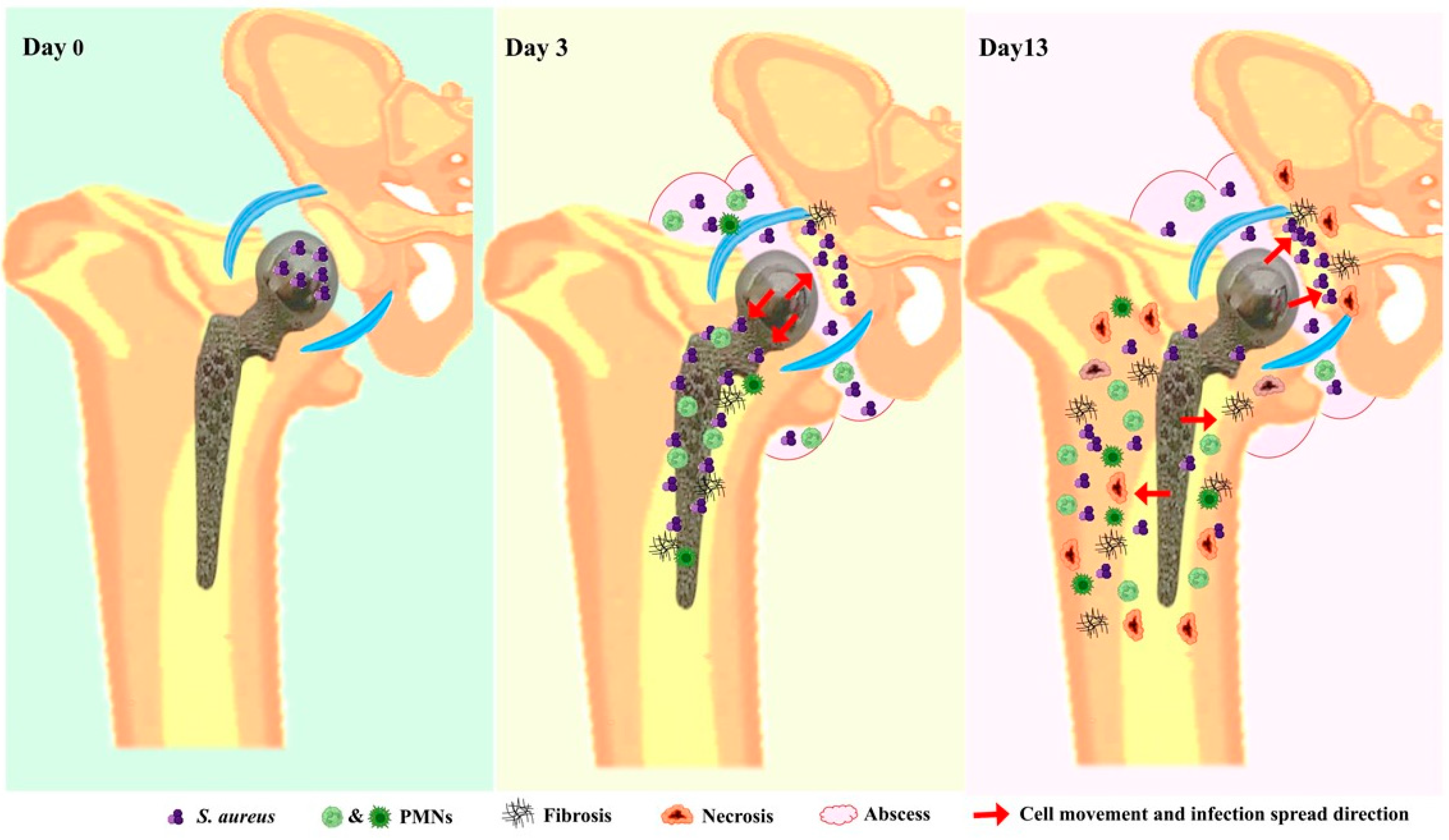 Mapping Staphylococcus aureus at Early and Late Stages of Infection in ...