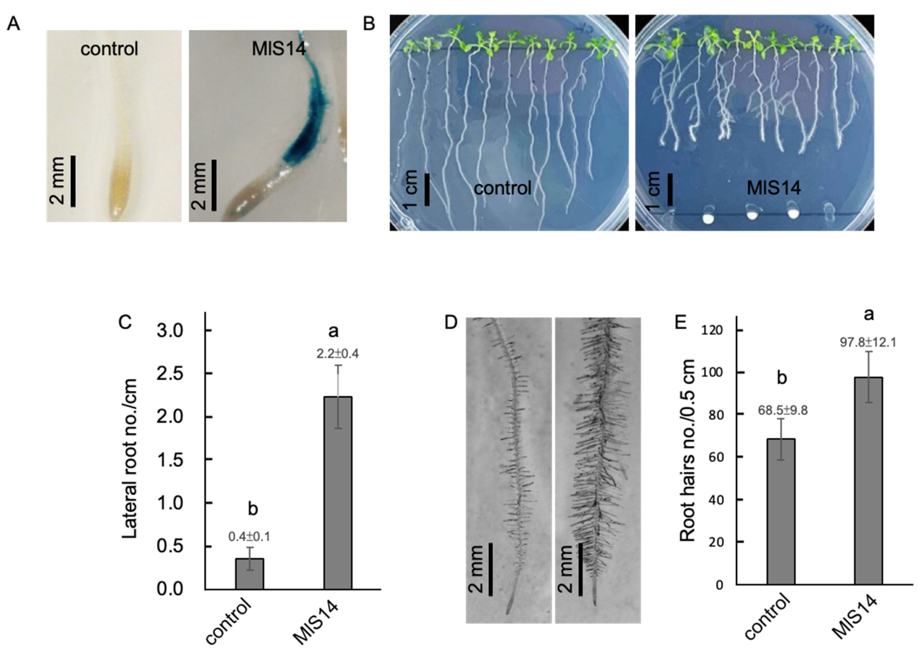 Decoding the Impact of a Bacterial Strain of Micrococcus luteus on ...