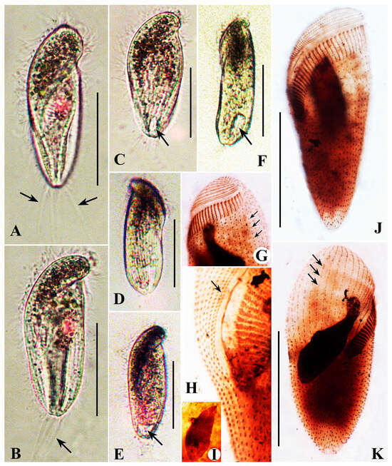 Morphology and Molecular Phylogeny of Four Anaerobic Ciliates (Protista ...