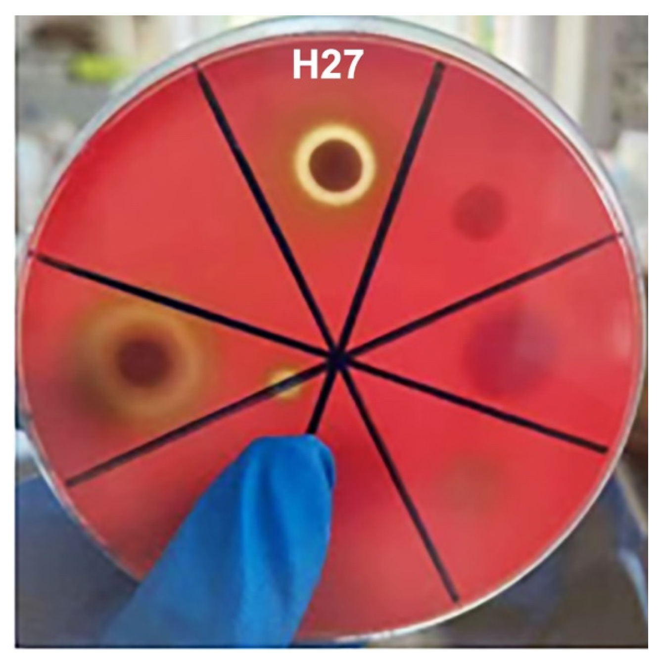 The Isolation and Identification of Pseudoalteromonas sp. H27, a Bacterial Strain Pathogenic to ...