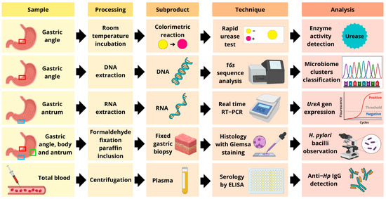 Concordance of Helicobacter pylori Detection Methods in Symptomatic ...