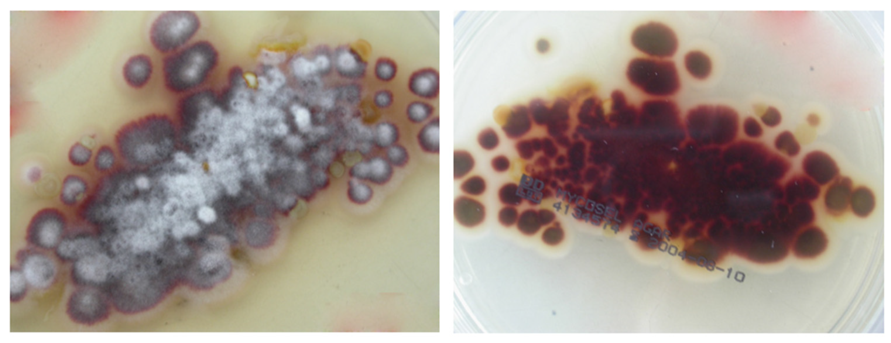 Case Report: From Misdiagnosis to Accurate Identification: Managing a ...