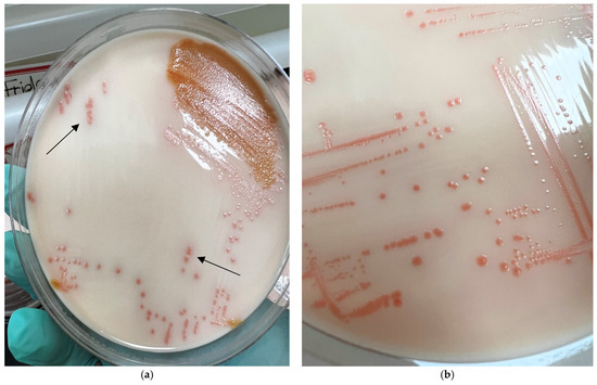 Molecular and Genetic Characterization of Arcobacter Species Isolated ...
