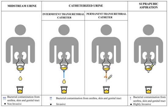 Basic Microbiome Analysis: Analytical Steps from Sampling to Sequencing