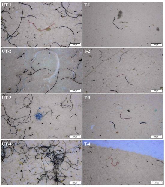 Mitigating Microfiber Pollution in Laundry Wastewater: Insights from a ...