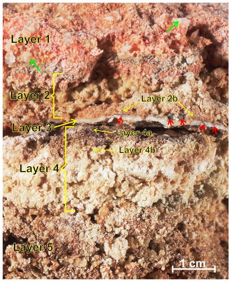 Contrasting Modes of Carbonate Precipitation in a Hypersaline Microbial Mat and Their Influence ...