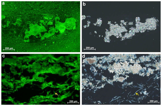 Contrasting Modes of Carbonate Precipitation in a Hypersaline Microbial Mat and Their Influence ...