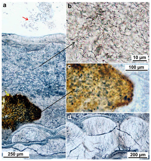 Contrasting Modes of Carbonate Precipitation in a Hypersaline Microbial Mat and Their Influence ...