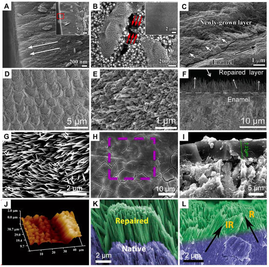 Progress in the Application of Biomimetic Mineralization for Tooth Repair