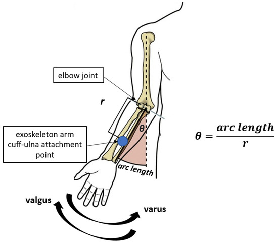 Modeling of Human-Exoskeleton Alignment and Its Effect on the Elbow ...