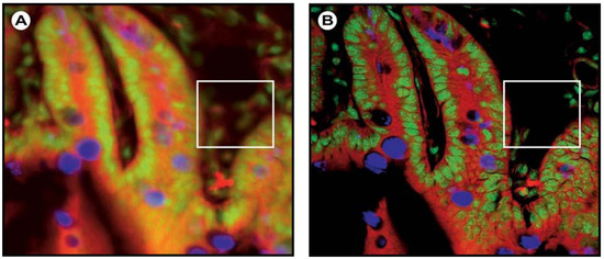 Advanced Fluorescence Microscopy Techniques—FRAP, FLIP, FLAP, FRET and FLIM