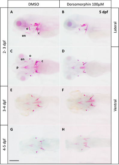 BMP Signaling Regulates Bone Morphogenesis in Zebrafish through ...
