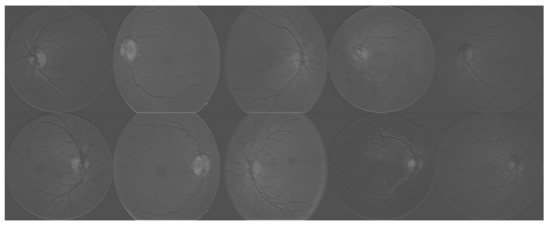 Deep Convolutional Neural Network Based Early Automated Detection Of Diabetic Retinopathy Using