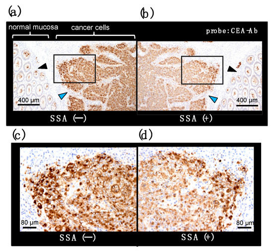 Lectin-Based Assay for Glycoform-Specific Detection of α2,6-sialylated ...